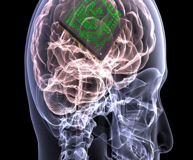 माइंड कंट्रोल चिप से होगा दिमागी बीमारियों का इलाज